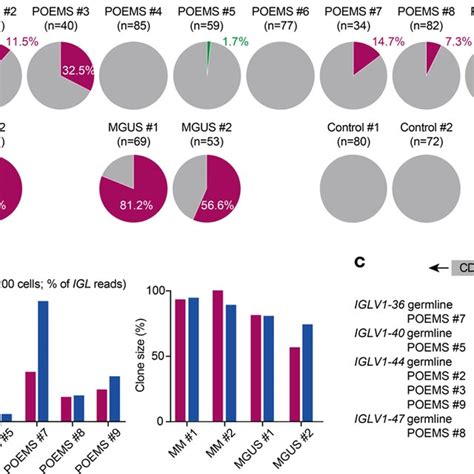 Identification Of Clonal Plasma Cells In Poems Syndrome A Igl