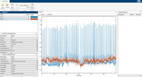 View Preprocess And Write Edf File