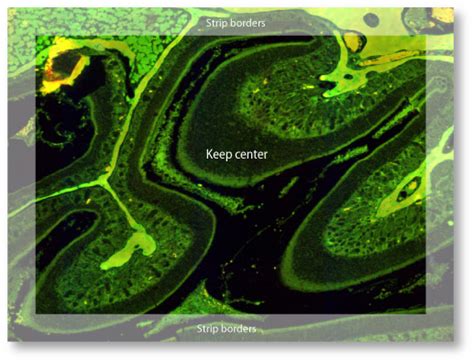 To Aid Image Processing For Pixel Precise Alignment Images Are Download Scientific Diagram