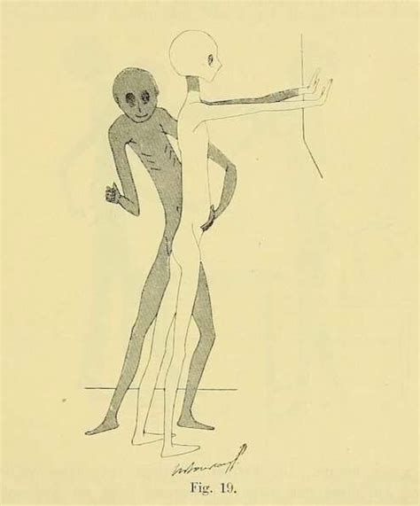 19th Century German Gynecology Textbook Illustrations Album On Imgur