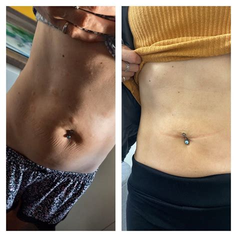 Before And After Inspired Wellness Mansfield