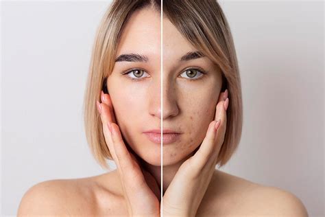 Achieve Glowing Skin With The Clinical Facial Fire And Ice Your Step