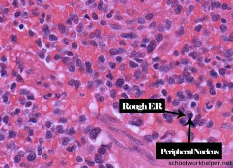 Spleen Slide Labelled Histology Schoolworkhelper Upload Educate
