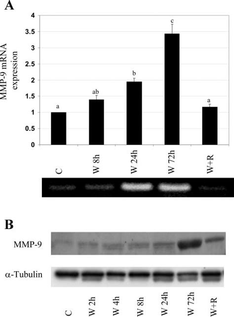 Upregulation Of Matrix Metalloproteinase Mmp 9 During Stromal Download Scientific Diagram