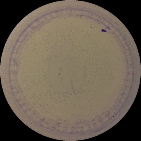 Opencv Segment Photos Of Bio Samples To Extract Circular Area Of