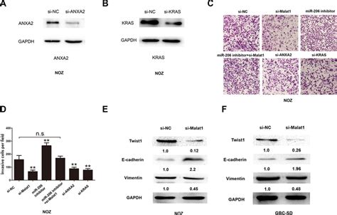 Cell Invasion Decreases After Silencing Malat1kras Or Anxa2 Signaling