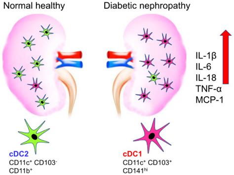 Figure 1 From Role Of Dendritic Cell In Diabetic Nephropathy Semantic Scholar