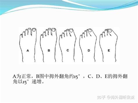 北京丰台广济医院科普大脚骨需要做哪些检查 知乎