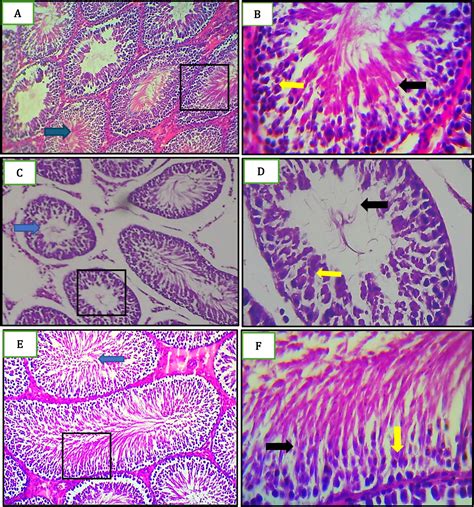 Impact Of Scutellarin On Cyclophosphamide Induced Testicular Damage In