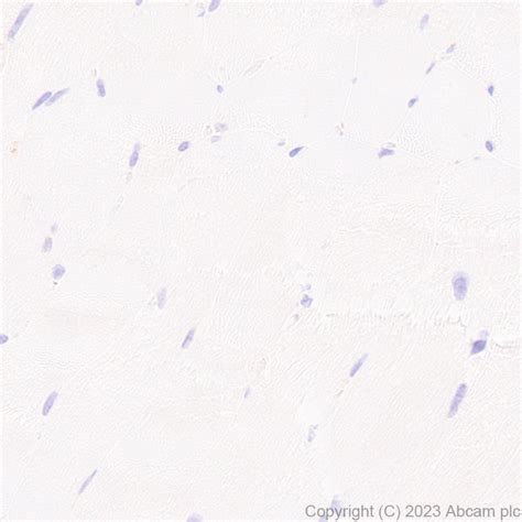 Glucose Transporter Glut3glut14重组抗体 Epr28481 54 Glucose Transporter