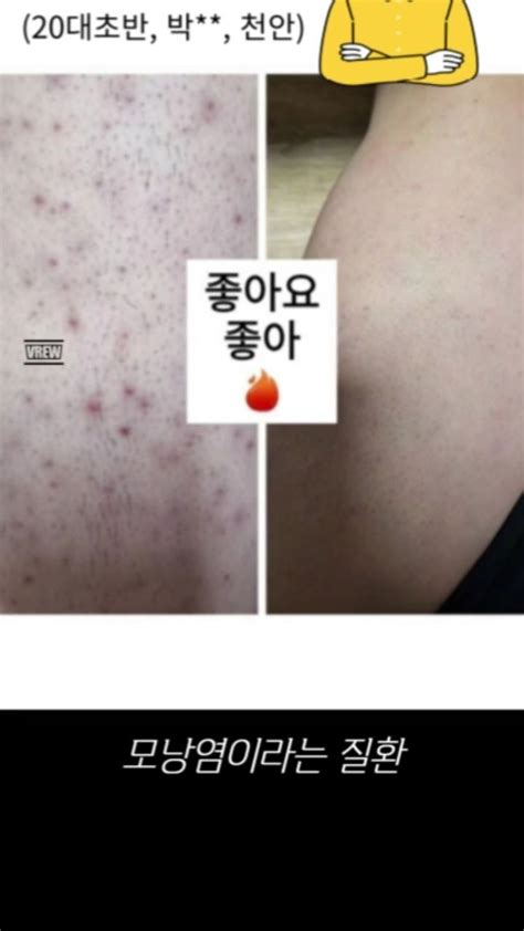 두통 통증 전립선개선 부인 만성두통 남편 어깨통증소변시원전립선완화 몸에 독소냄새가 많이 났는데 지금은 없어졌다고