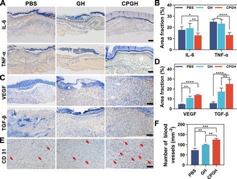 Anti Inflammatory And Angiogenesis Effect Analysis Of The Hybrid