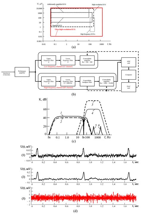 Diagnostics Free Full Text Ultra High Resolution Electrocardiography Enables Earlier