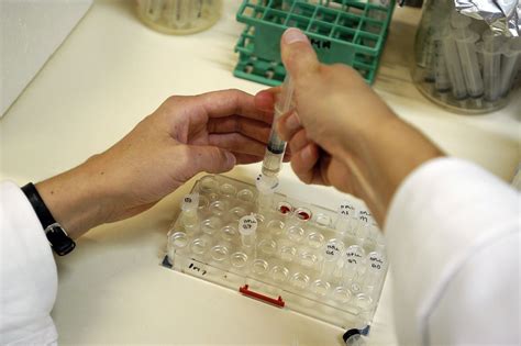 A Skeptical Look At Screening Tests Science Based Medicine