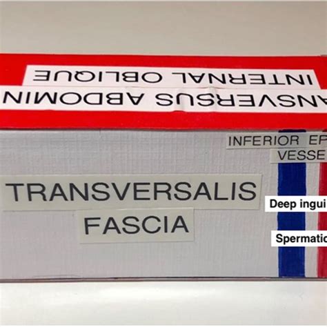 The Posterior Wall Of The Right Inguinal Canal Model Showing The
