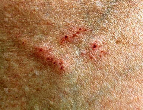 皮肤上有割伤和抓伤。伤口和擦伤