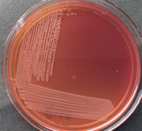 Macconkey Agar Composition Uses Colony Characteristics Artofit