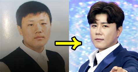 동일 인물이라고서바이벌 프로그램 우승자 믿기지 않는 성형 전 공개 위키트리