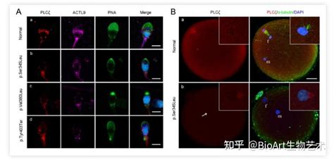 中南湘雅林戈课题组首次揭示男性actl9纯合突变导致受精失败的机制，并提供有效干预方案 知乎