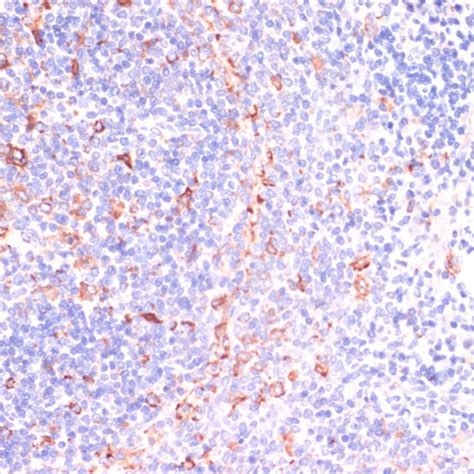 Ikk Epsilon Antibody Pa5 87387