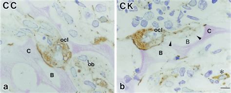 Light Micrographs Of 1 M Cryosections Of The Proximal Epiphysis Of