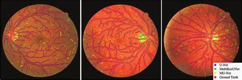 Comparison Of Segmentation Results On Drive Dataset Download Scientific Diagram