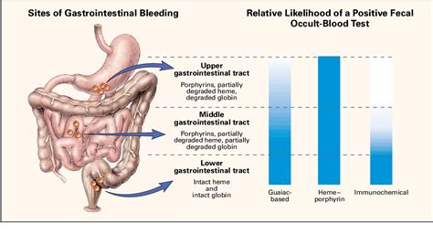 Figure 2 From Occult Gastrointestinal Bleeding Semantic Scholar
