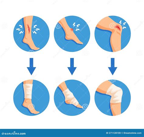 Bandage Or Hip Bandaging Stretching Or Dislocation Medical Treatment