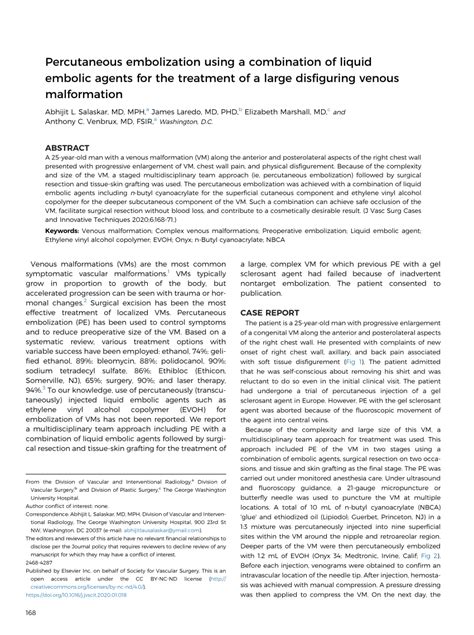 Pdf Percutaneous Embolization Using A Combination Of Liquid Embolic Agents For The Treatment