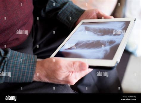 Chest Radiograph Hi Res Stock Photography And Images Alamy