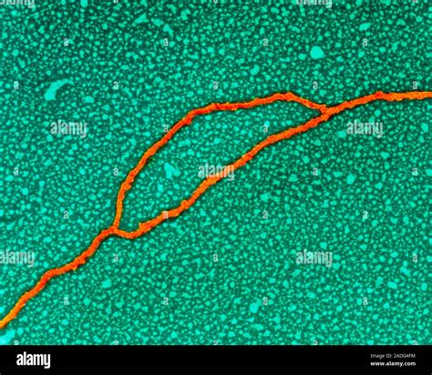Dna Replication Coloured Transmission Electron Micrograph Tem Of Human Dna From A Hela Cancer
