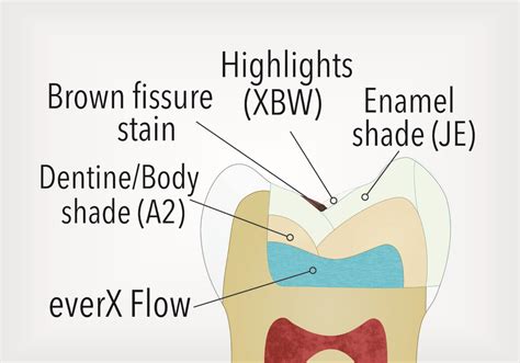 Go With The Flow Een Cusp By Cusp Additieve Techniek Met Injecteerbaar