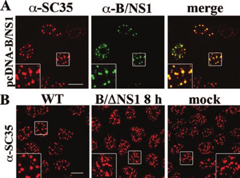 The Bns1 Protein Accumulates In Nuclear Speckles In The Absence Of