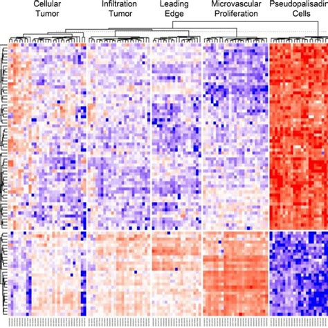 Geographic Tumor Location Based Classification Of Ivy Gap Glioblastoma