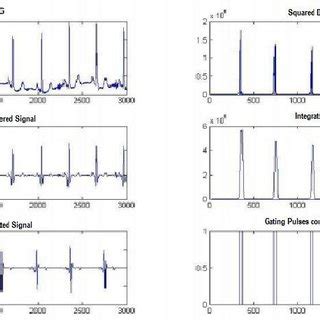 Pulse Shaping Steps Download Scientific Diagram