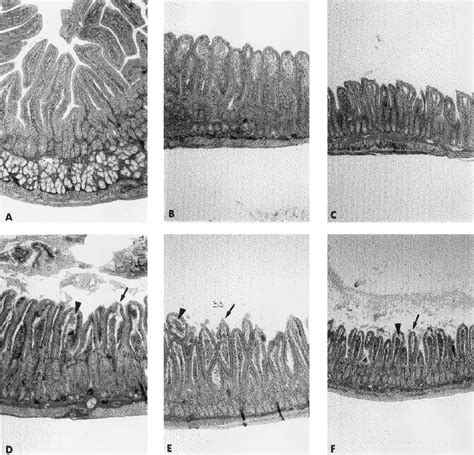 Histological Photographs Showing The Alterations In The Three Regions