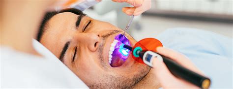 Composite Fillings Near You Immediate Smiles Dentistry