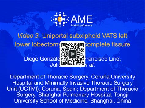 Uniportal Subxiphoid Vats Left Lower Lobectomy With Uncomplete Fissure Download Scientific