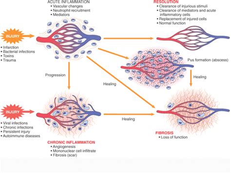 Diagram Of Manifestations Of Inflammation Quizlet