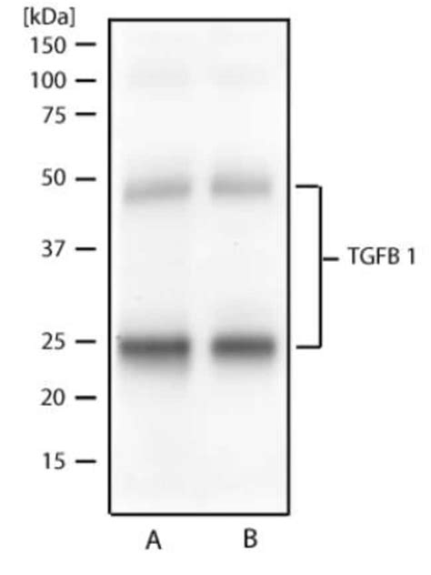 Lap Tgf Beta 1 Mouse Anti Human Mouse Rat Clone 7f6 Novus