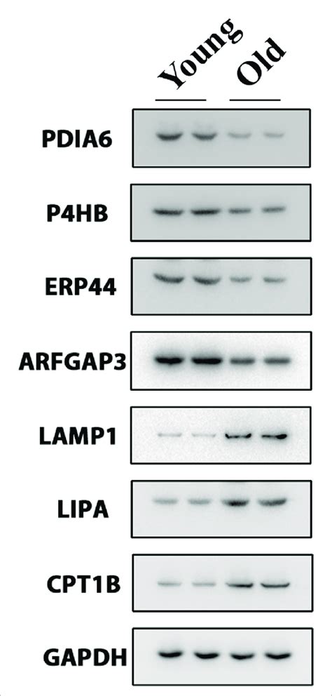 Western Blot Experiment Verified The Key Differentially Expressed
