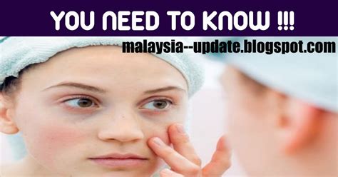 10 Early Warning Signs Of Lupus You Need To Know