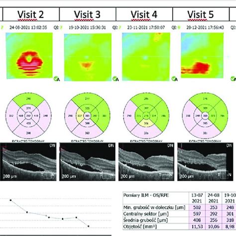 Changes In Retinal Morphology In The Course Of CSCR In The RE Download Scientific Diagram