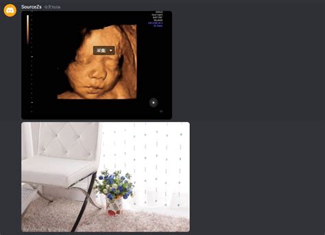 AI绘画新玩法 AI生成宝宝四维彩超图太可爱了 AI chatGPT 长臂猿 企业应用及软件系统平台