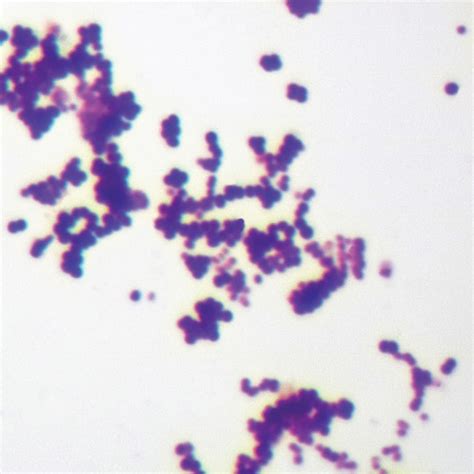 Gram Positive Vs Gram Negative Microscope