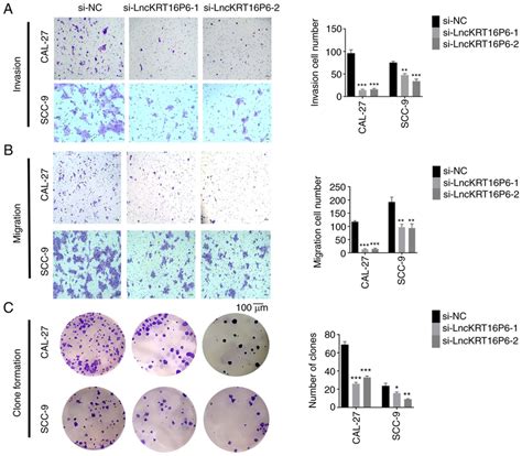 Lnckrt16p6 Promotes Tscc Progression In Vitro A Representative