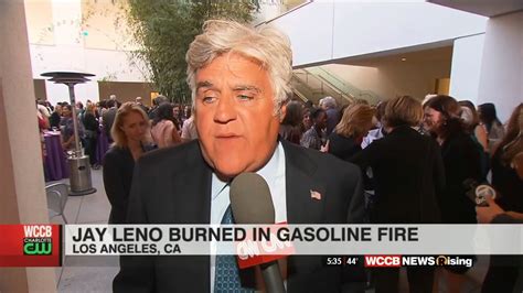 Jay Leno Breaks Bones In Motorcycle Wreck Months After Fire Wccb