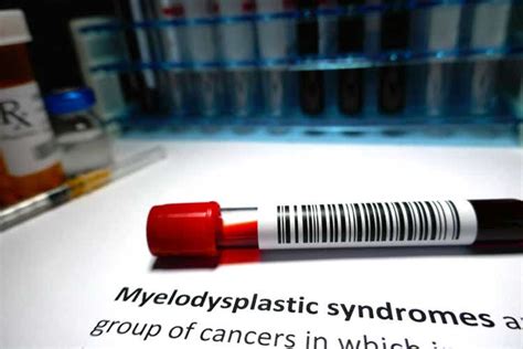 Bristol Myers Merck Partnered Blood Cancer Therapy Succeeds In Phase 3