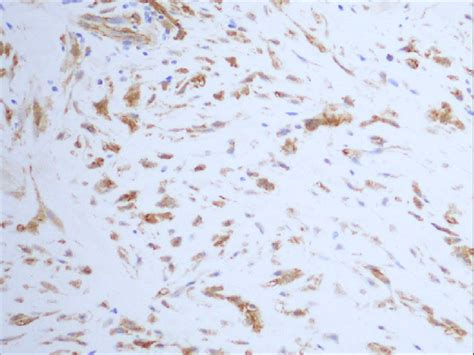 Staining For Beta Catenin Download Scientific Diagram