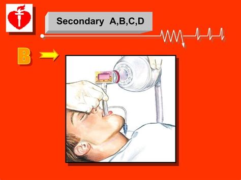 Acls Mega Code Pdf PDF First Aid Injuries
